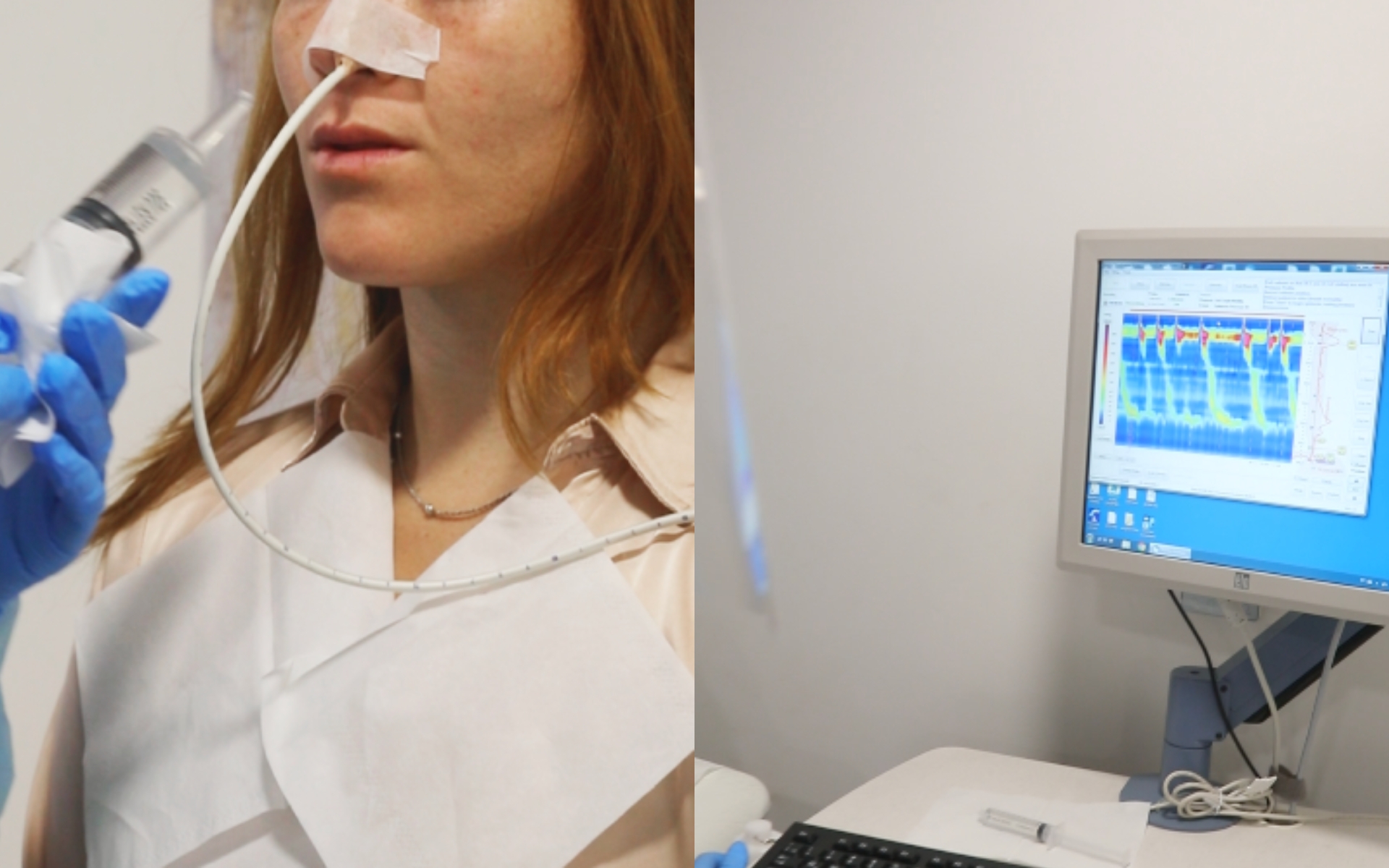 Manometría esofágica: diagnóstico del reflujo gastroesofágico - Clinyco